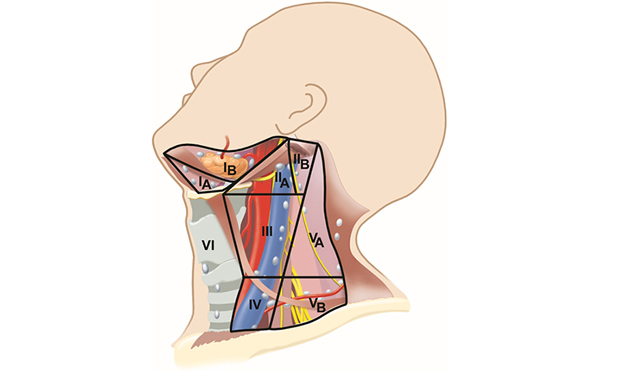 Topic: Lymph Node Metastases in the Neck