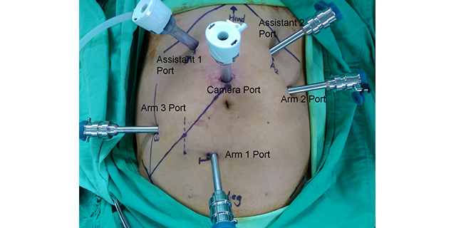 Topic: A Bespoke Approach to Rectal Cancer Resection and Management