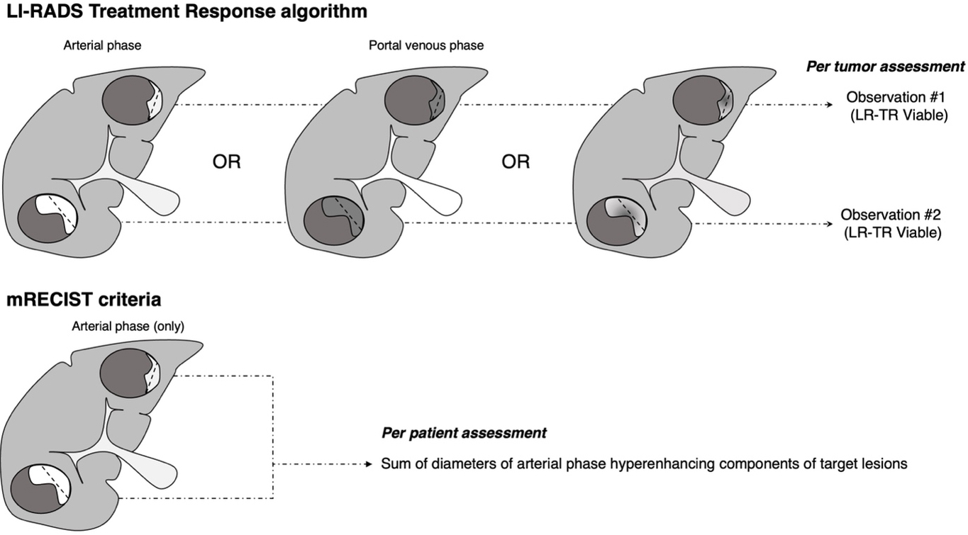 Topic: Interventional Radiology in Treatment of Hepatocellular Carcinoma