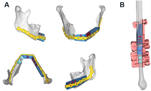 Topic: Microvascular Free Flap Reconstruction of the Head and Neck