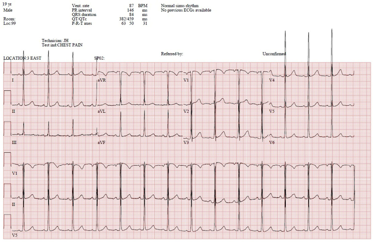 The first INSPIRIS RESILIA Aortic Valve TM replacement (Edwards ...