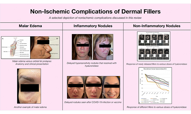 Topic: Management of Dermal Filler Complications