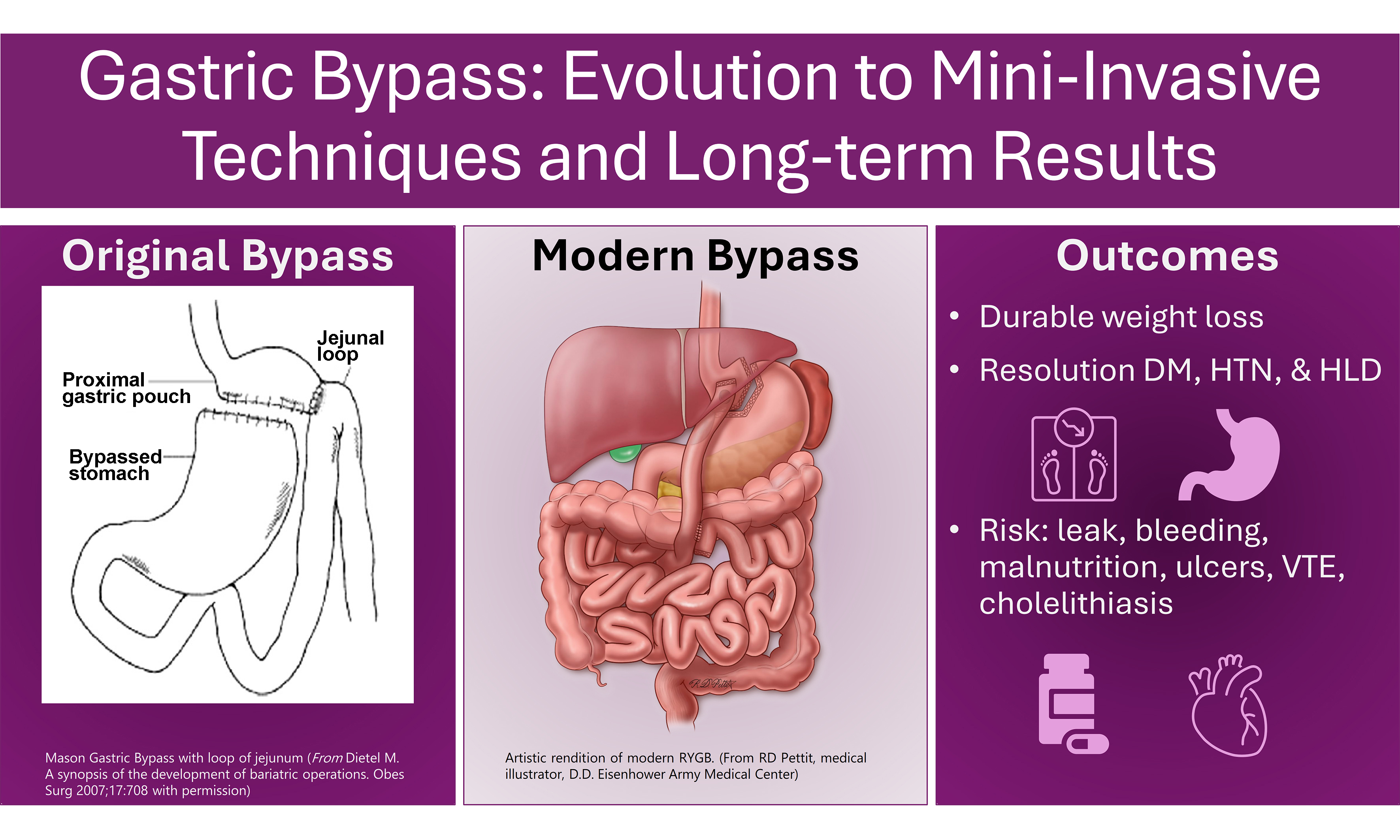 Mini invasive Surgery MIS OAE Publishing Inc Mini invasive Surgery MIS OAE Publishing Inc