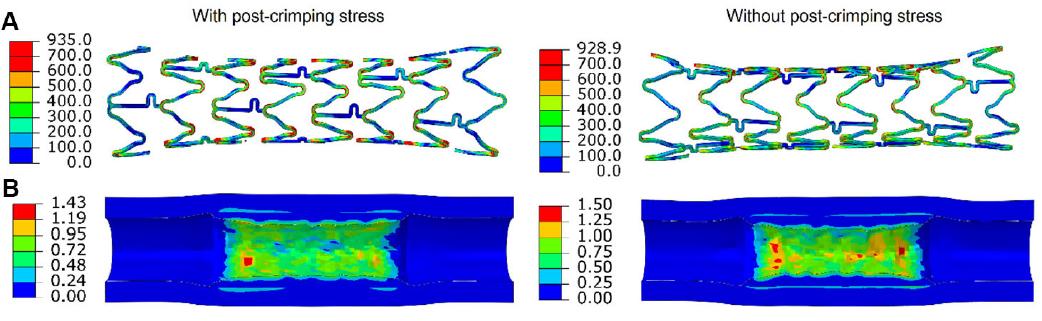 Crimping and deployment of metallic and polymeric stents -- finite ...